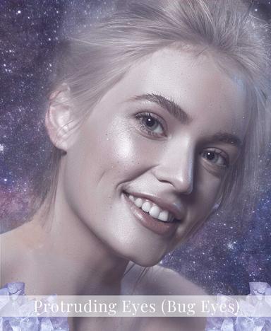 Protruding Eyes (Bug Eyes) Meaning | Learn Chinese Face Reading ...